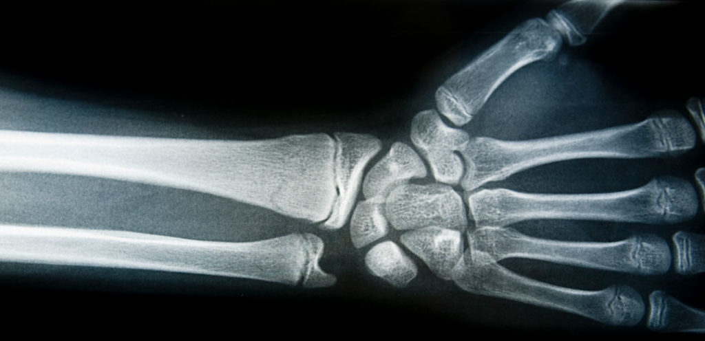 HandWrist - Trinity Health